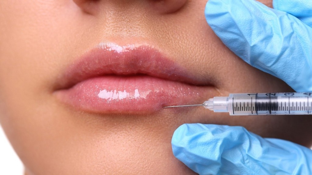 Conheça 4 tipos de preenchimento labial e saiba como escolher - Ponta ...